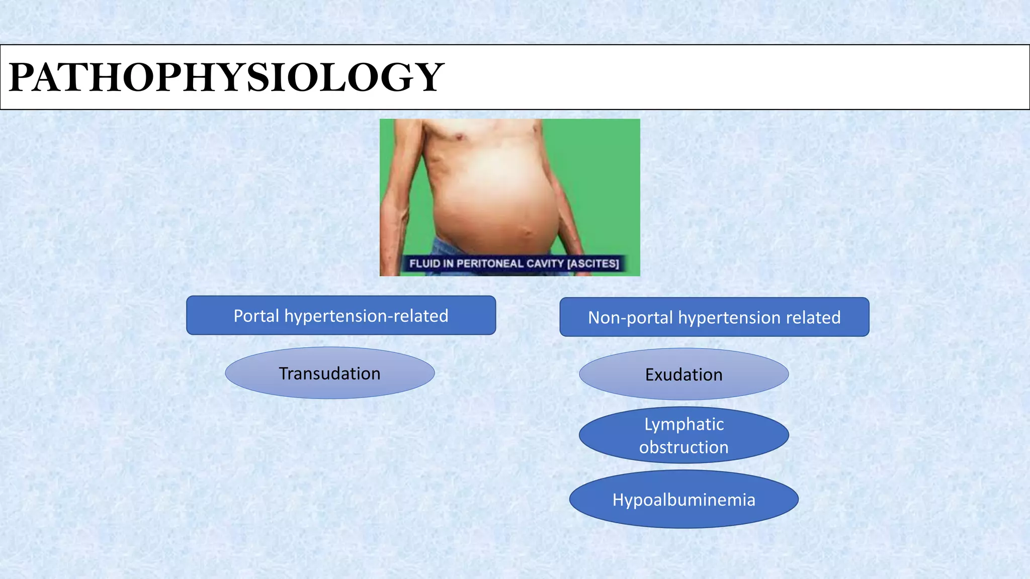 3. ASCITES part 1.pdf