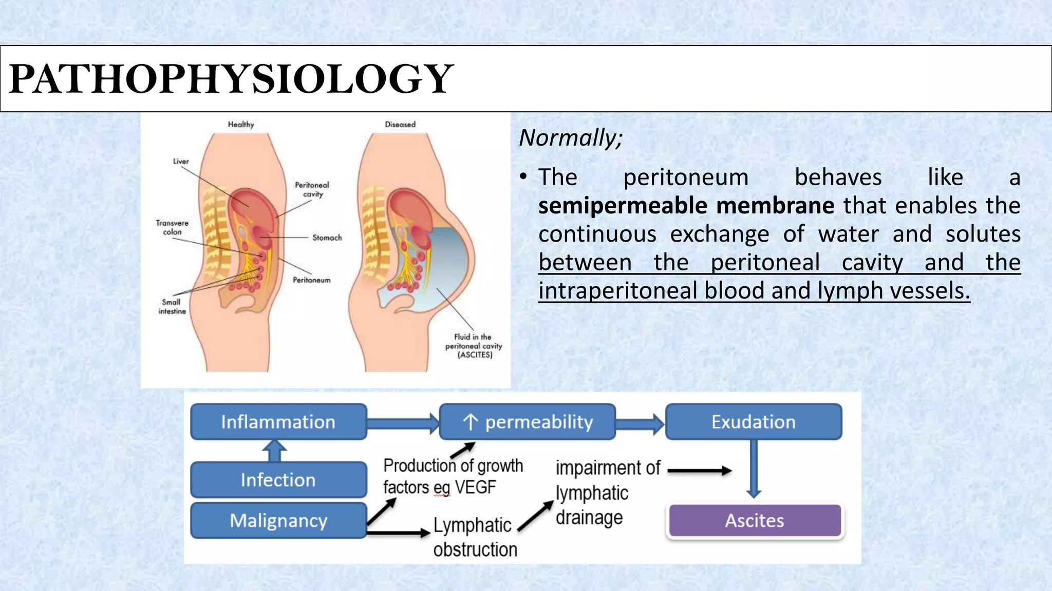 3. ASCITES part 1.pdf