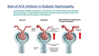 3. Roles of ACEI in Diabetic Nephropathy.pptx