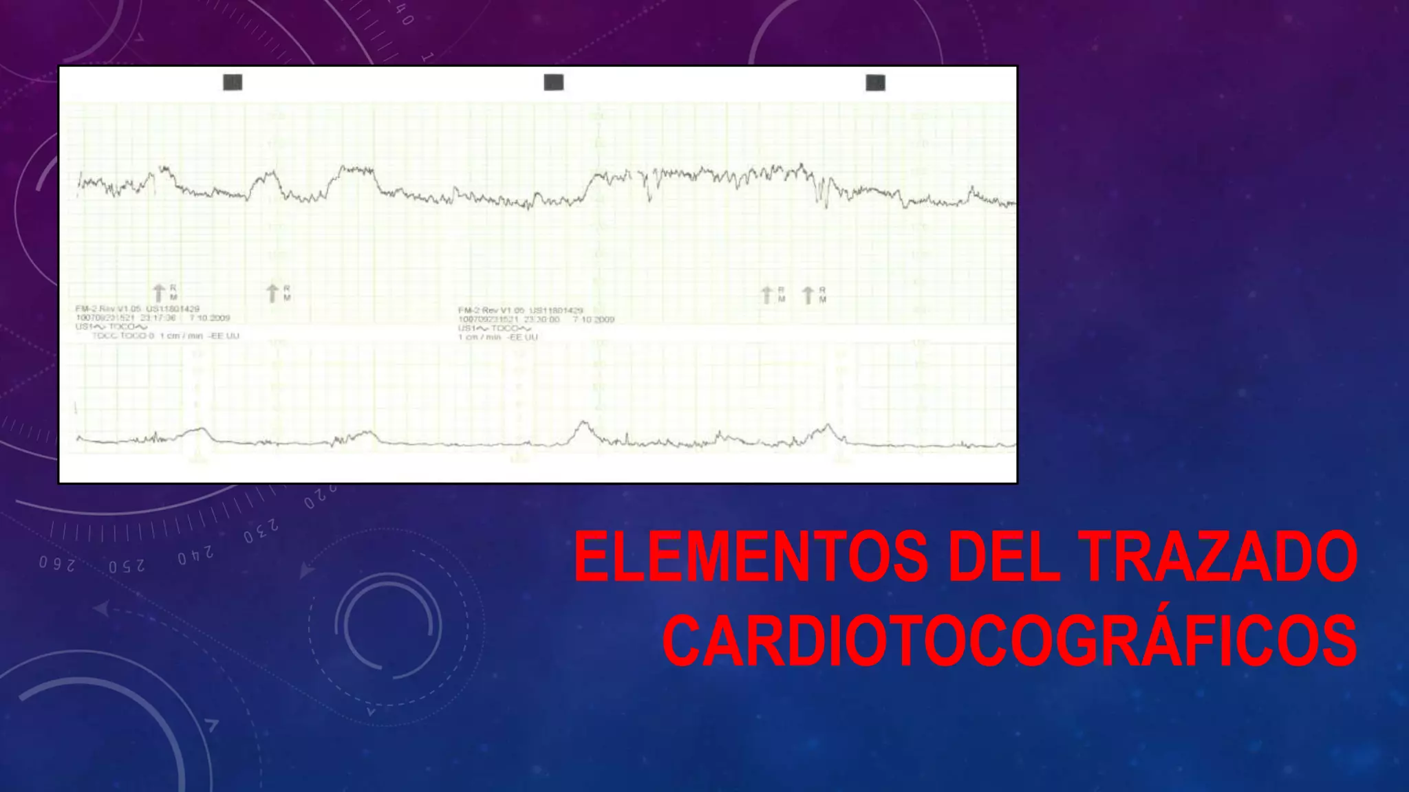 3.Elementos del trazado cardiotocográficosLB.pptx