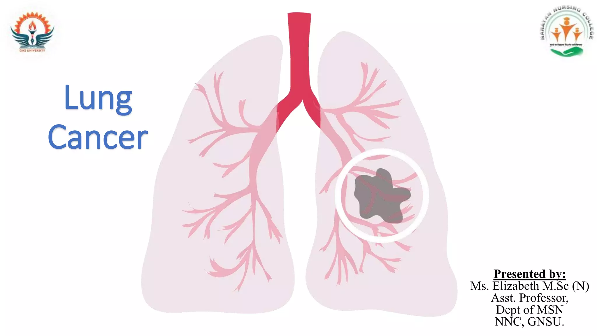 3. Lung Cancer -for nursing students | PPTX