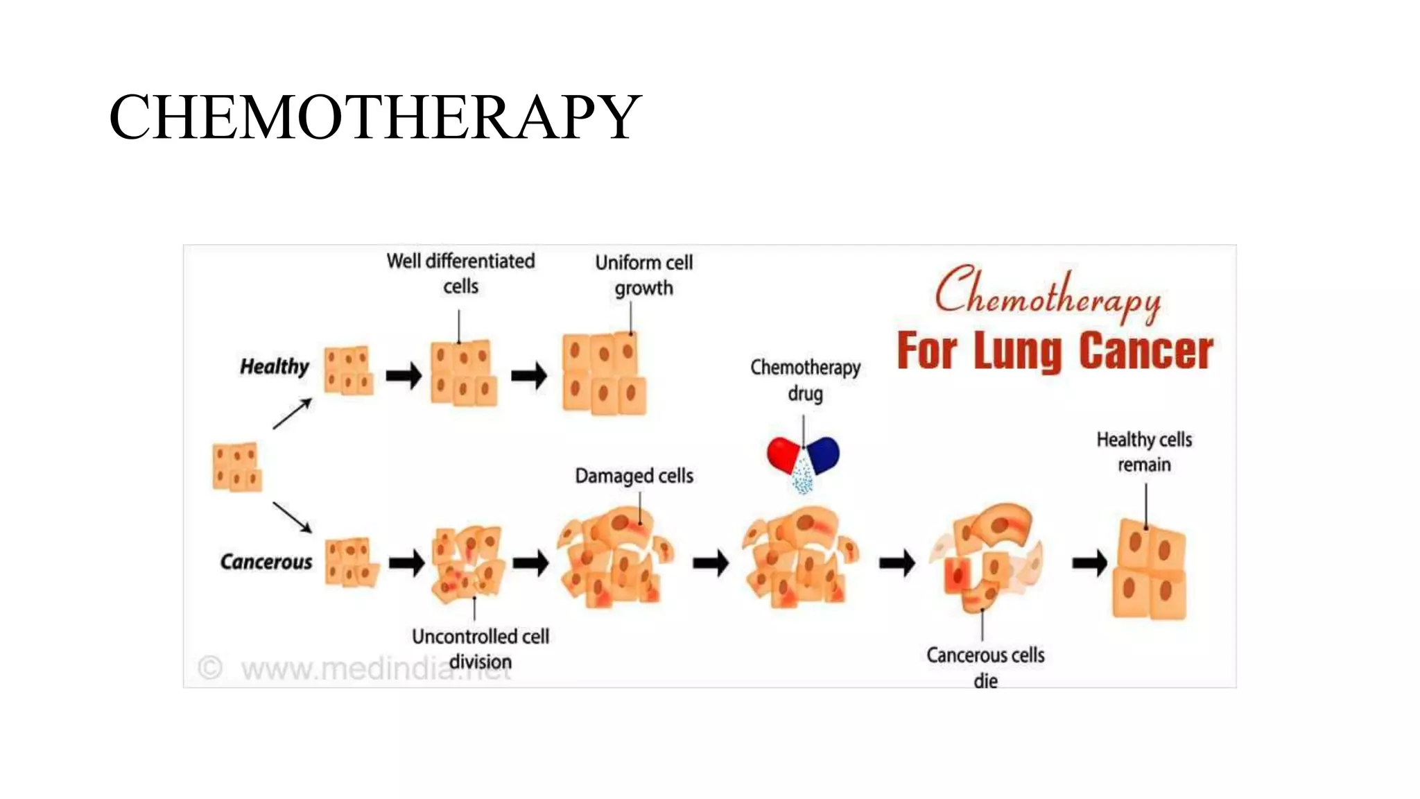 3. Lung Cancer -for nursing students | PPTX