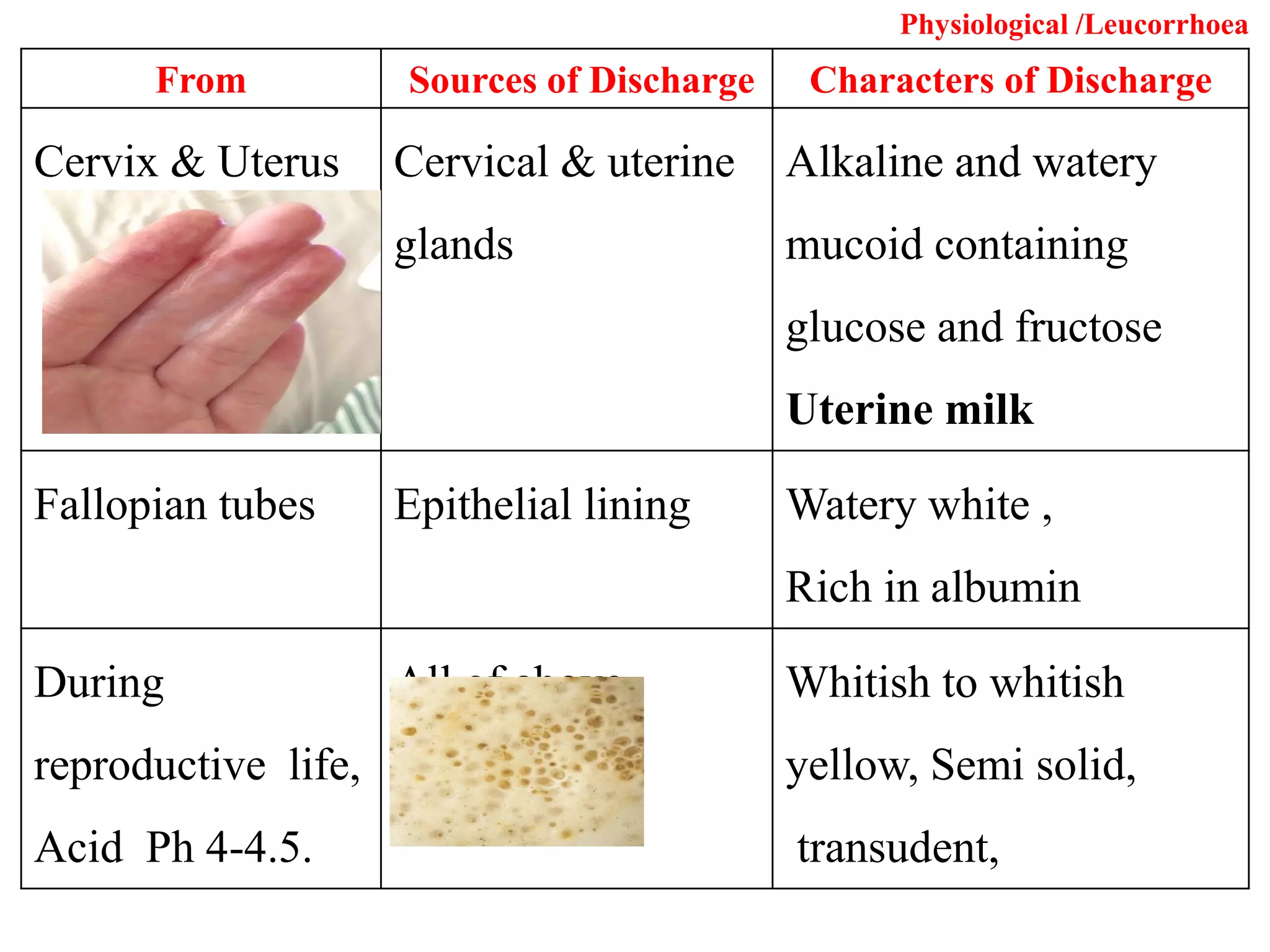 3.4 - Physiological Vaginal Discharge.pdf