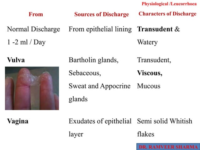 3.4 - Physiological Vaginal Discharge.pdf