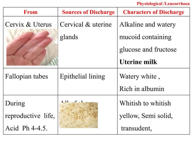 3.4 - Physiological Vaginal Discharge.pdf