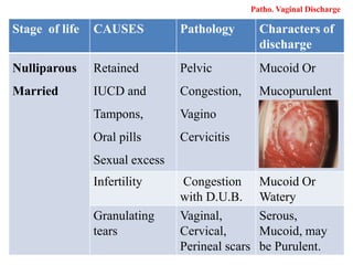 3.5 - Pathological Vaginal Discharge.pdf