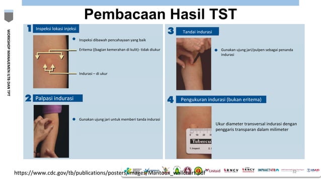 3. Diagnosis ILTB_RT_FFY.pptx