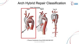 aortic banding | PPT