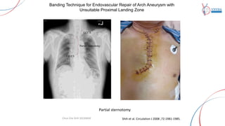 aortic banding | PPT