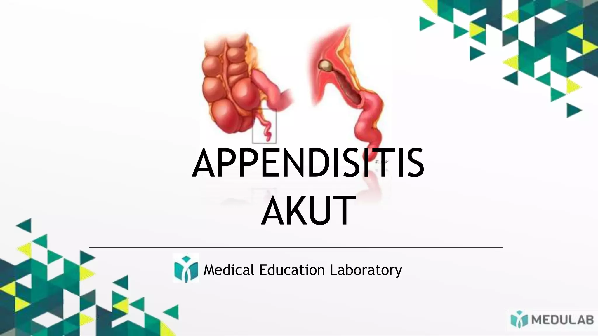 3. AKUT ABDOMEN.pptx