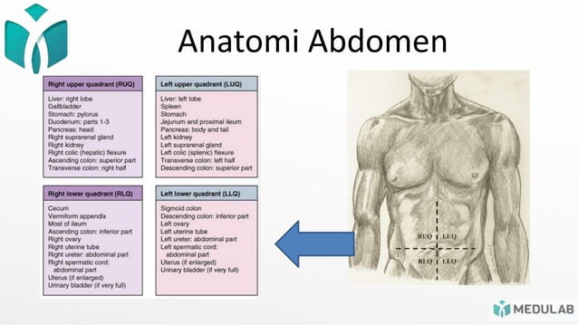 3. AKUT ABDOMEN.pptx