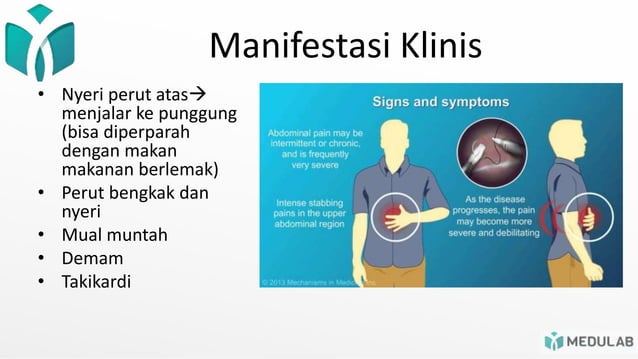 3. AKUT ABDOMEN.pptx