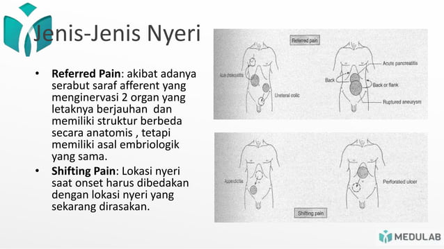 3. AKUT ABDOMEN.pptx