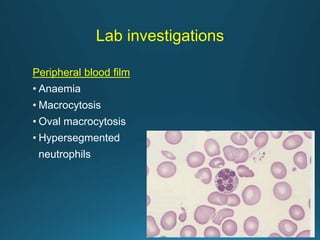 3. Anaemia - Macrocytic anaemias.pptx