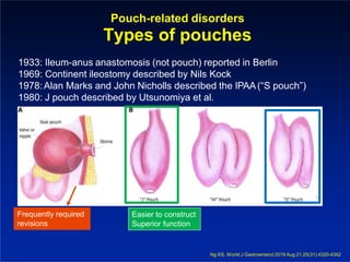 3. Ananthakrishnan - Management of Severe UC and Pouch-Related ...