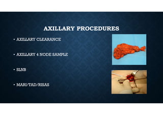 3.1 Surgical management of Axilla, ABDA 2023.pdf