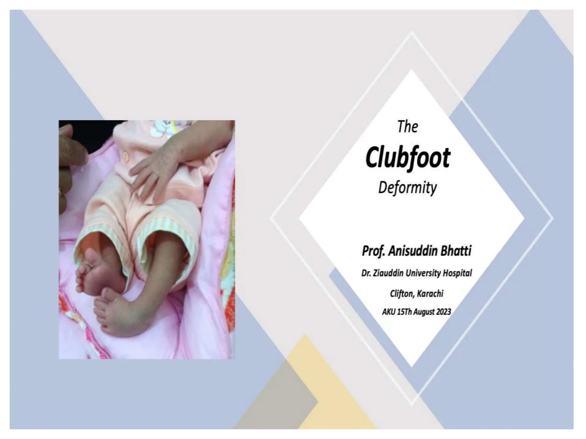 CLUBFOOT Rx Principles AKU.ppt