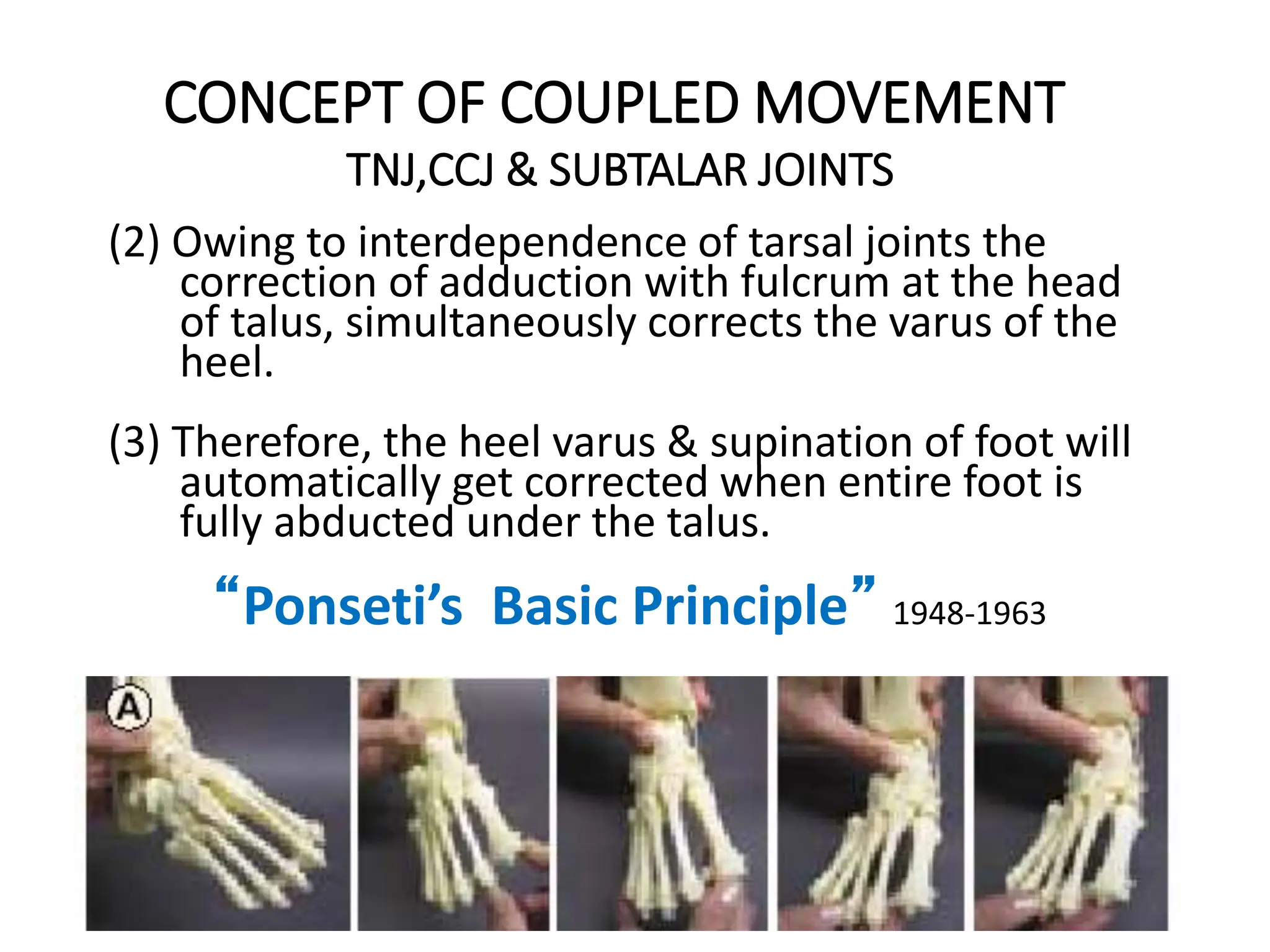 CLUBFOOT Rx Principles AKU.ppt