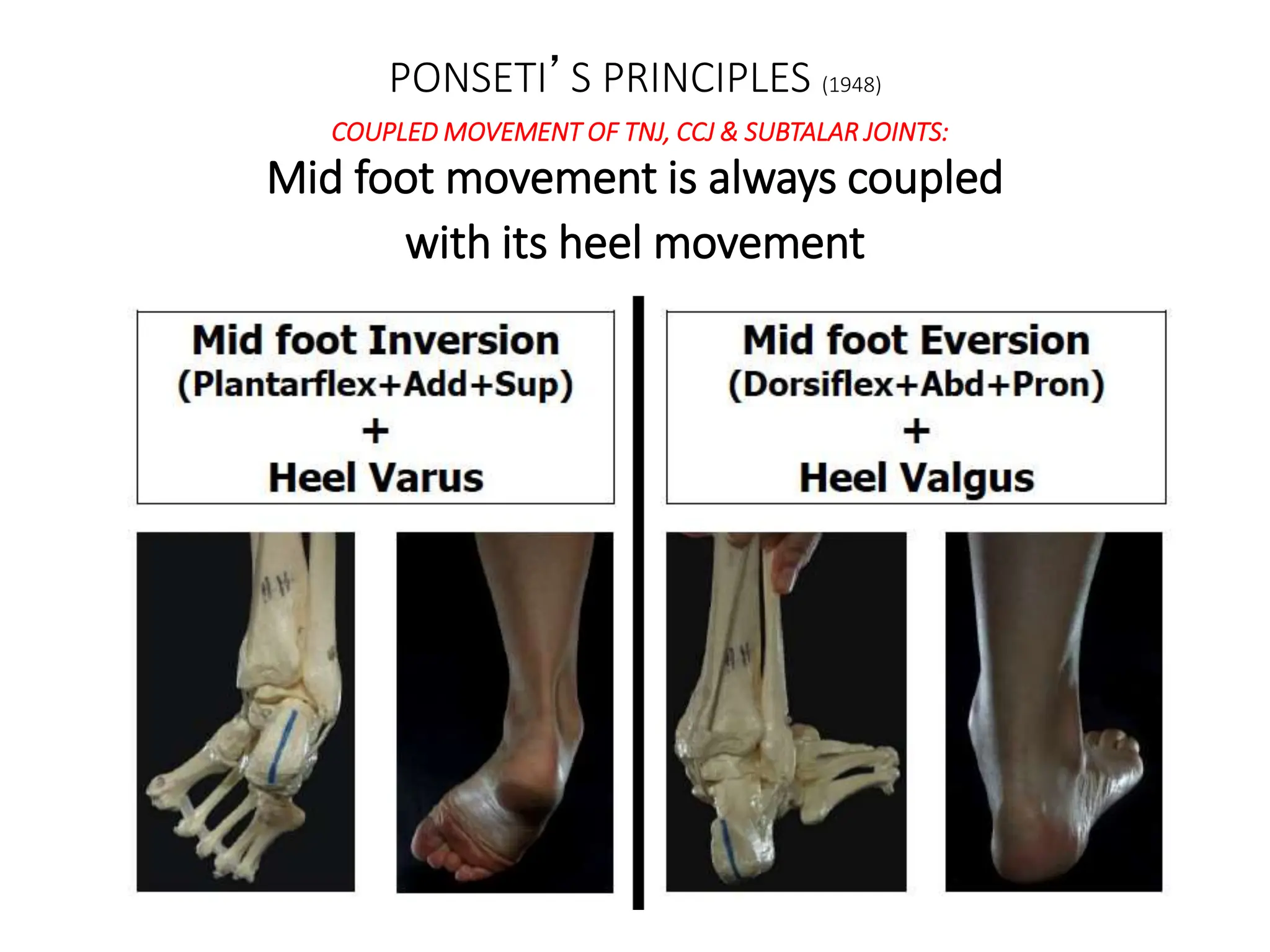 CLUBFOOT Rx Principles AKU.ppt