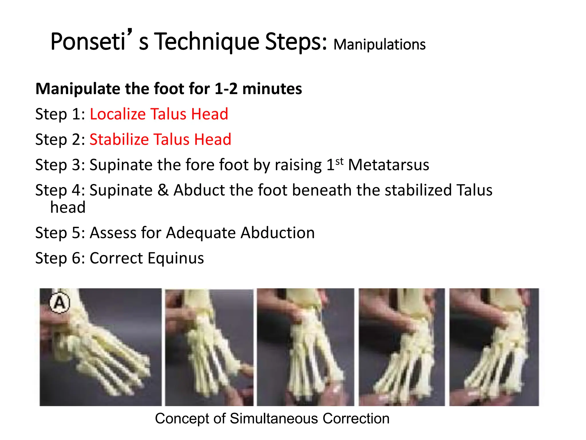 CLUBFOOT Rx Principles AKU.ppt