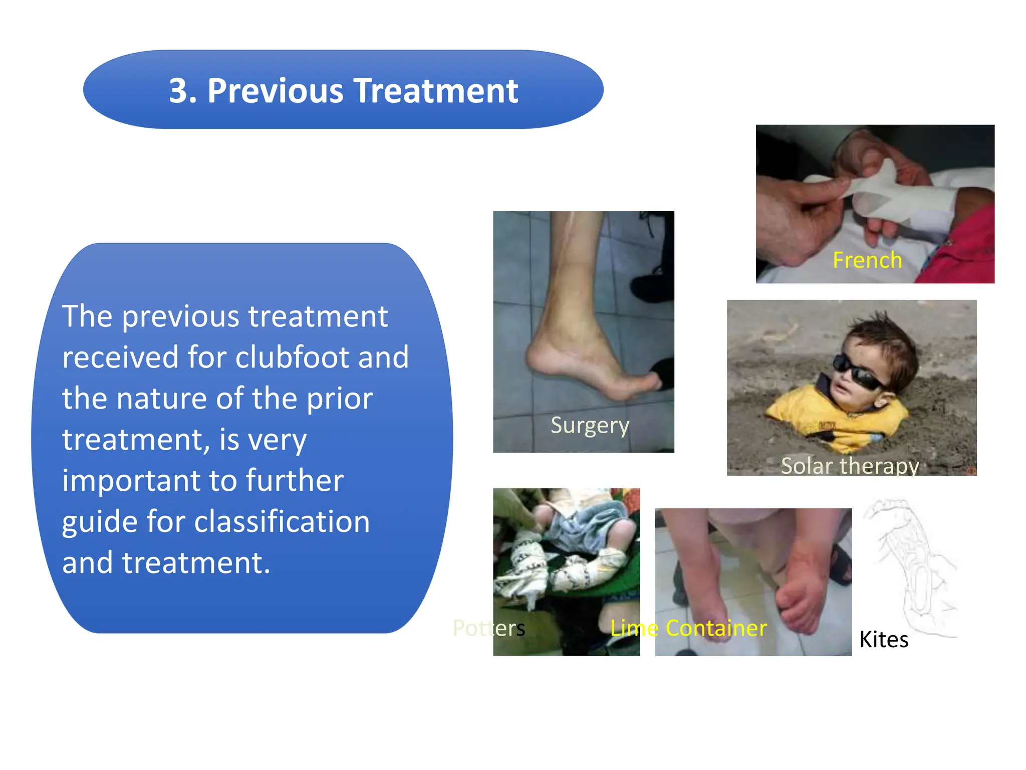 CLUBFOOT Rx Principles AKU.ppt
