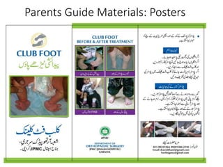 CLUBFOOT Rx Principles AKU.ppt