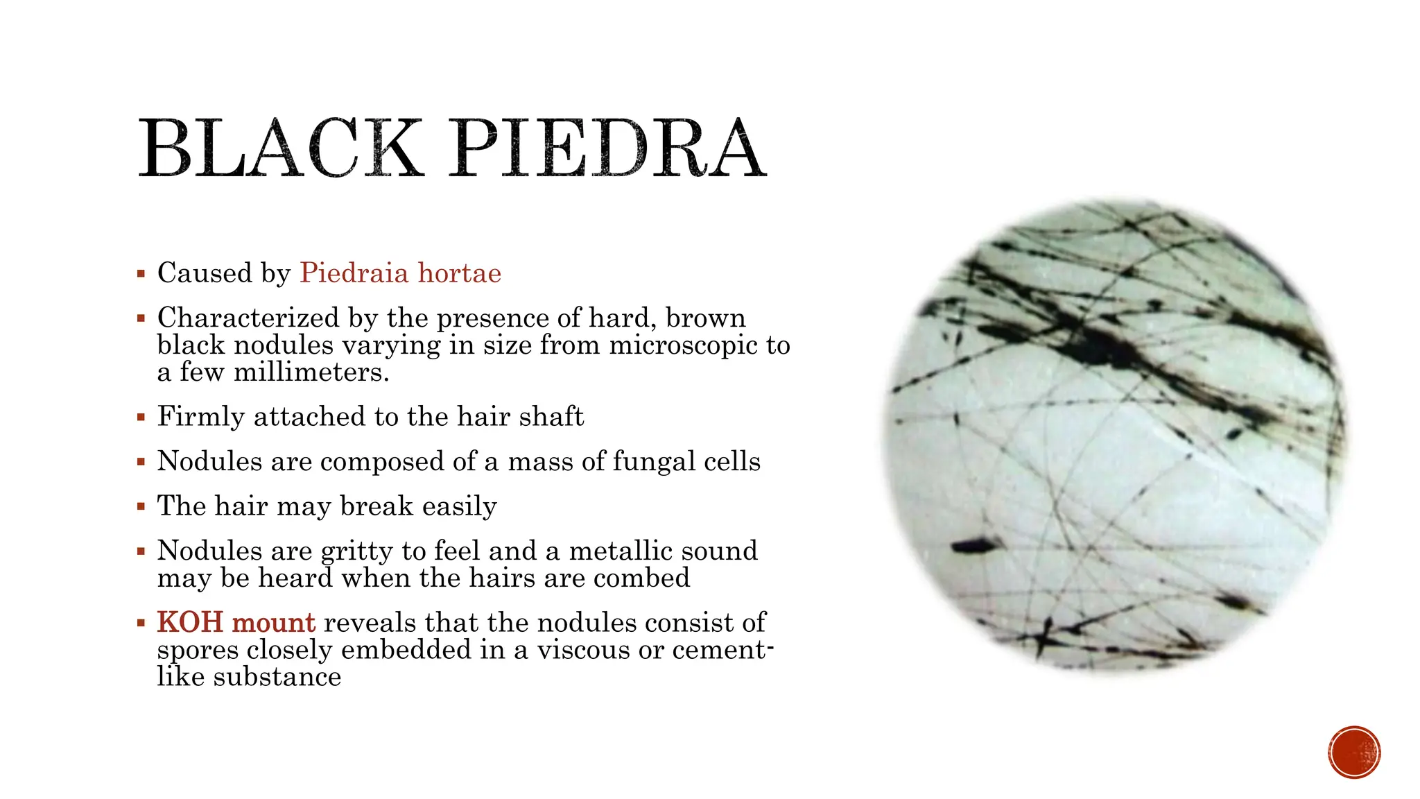 Superficial Fungal Infections | PPTX