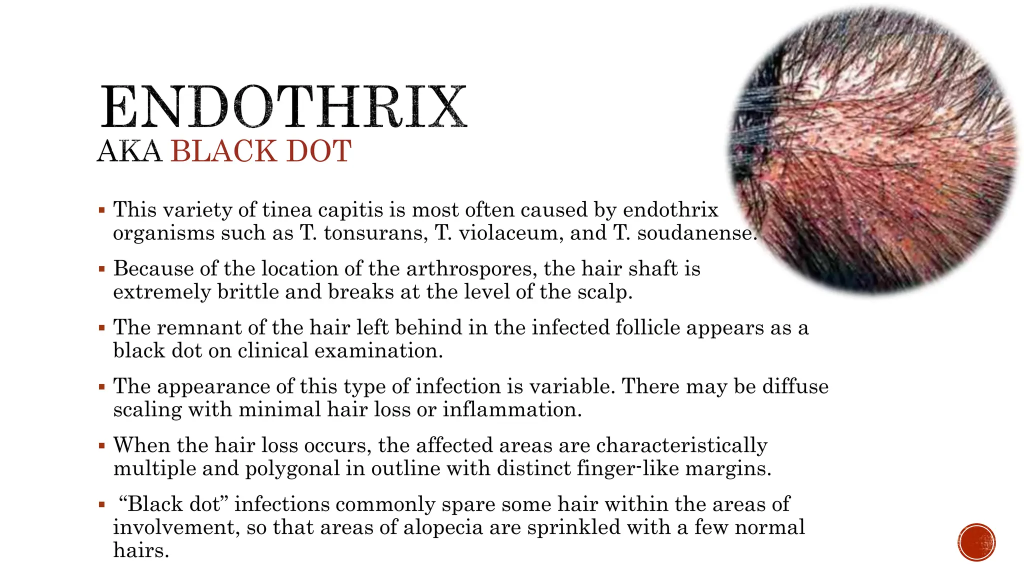 Superficial Fungal Infections | PPTX