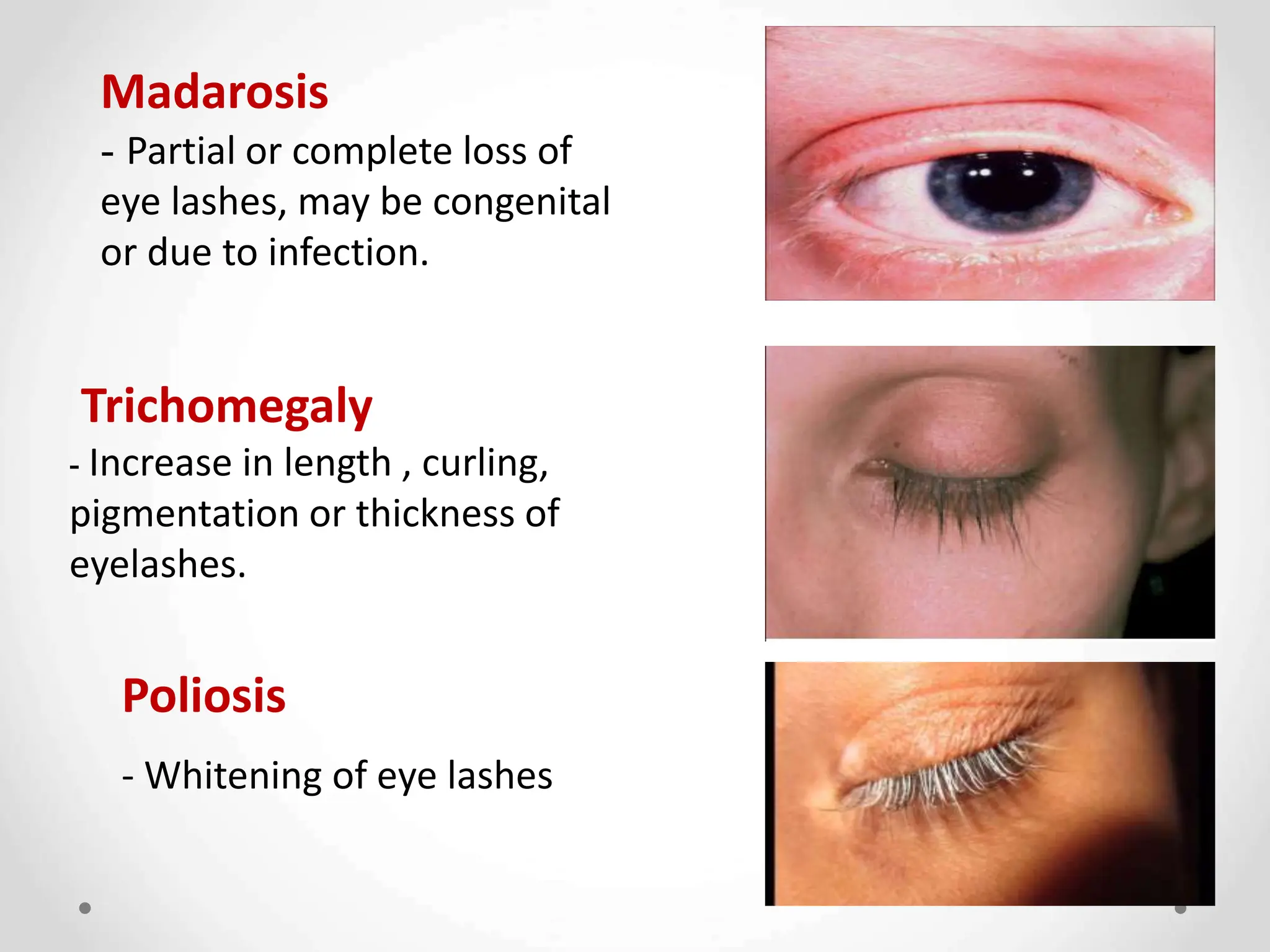 Anatomy of Eyelid, Introduction to Orbit | PPT