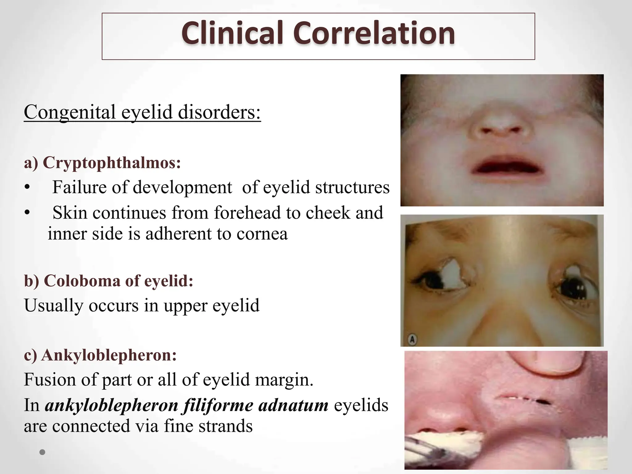 Anatomy of Eyelid, Introduction to Orbit | PPT