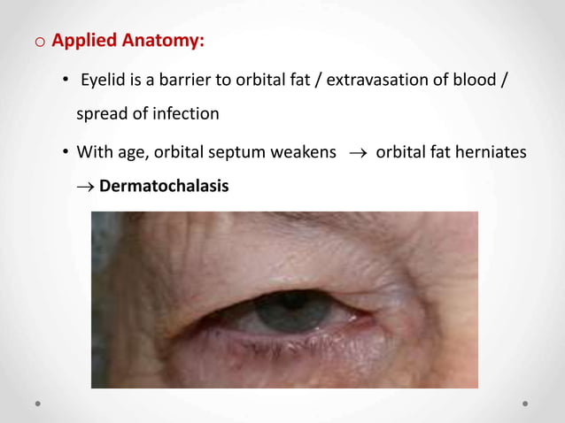 Anatomy of Eyelid, Introduction to Orbit | PPT
