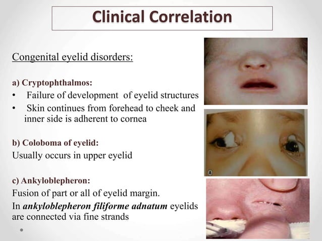 Anatomy of Eyelid, Introduction to Orbit | PPT