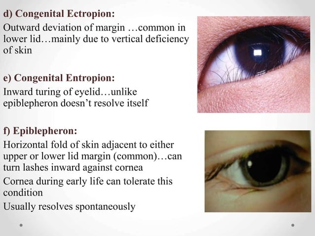 Anatomy of Eyelid, Introduction to Orbit | PPT