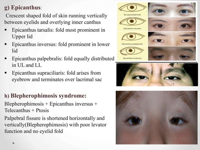 Anatomy of Eyelid, Introduction to Orbit | PPT