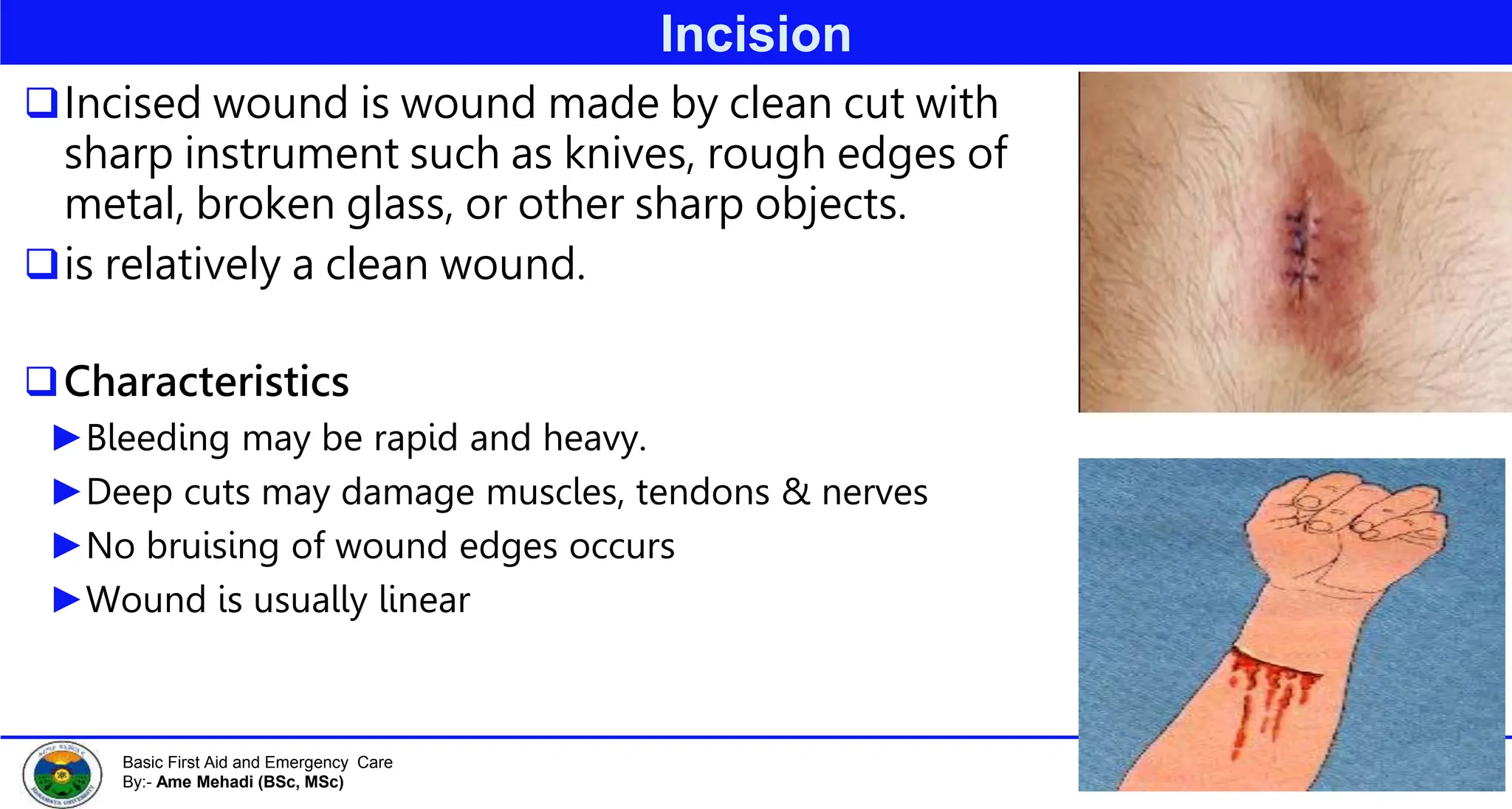 3. Wounds & Bleeding (2).pptx