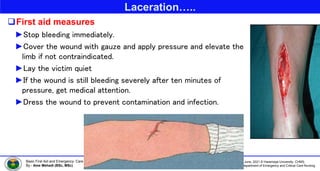 3. Wounds & Bleeding (2).pptx