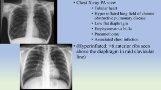 1. COPD (Chronic Obstructive Pulmonary Disease) | PPTX | Lung and ...