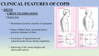 1. COPD (Chronic Obstructive Pulmonary Disease) | PPTX | Lung and ...