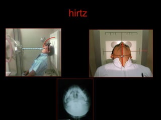 3.- proyecciones radiograficas de craneo.ppt