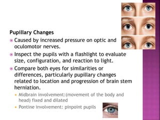 intracranial pressure nursing care process | PPTX