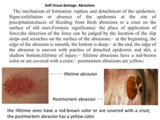 3 ангhydsetgbddrjhfreddnjhfdddrgggddrtgff | PPT