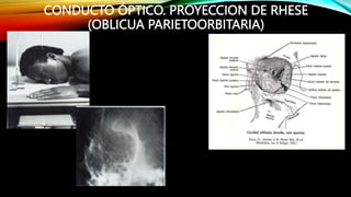 3.2.- ANATOMIA Y RADIOLOGIA DE CRANEO - PARTE II.pptx