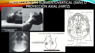 3.1.- ANATOMIA Y RADIOLOGIA DE CRANEO - PARTE I.pptx
