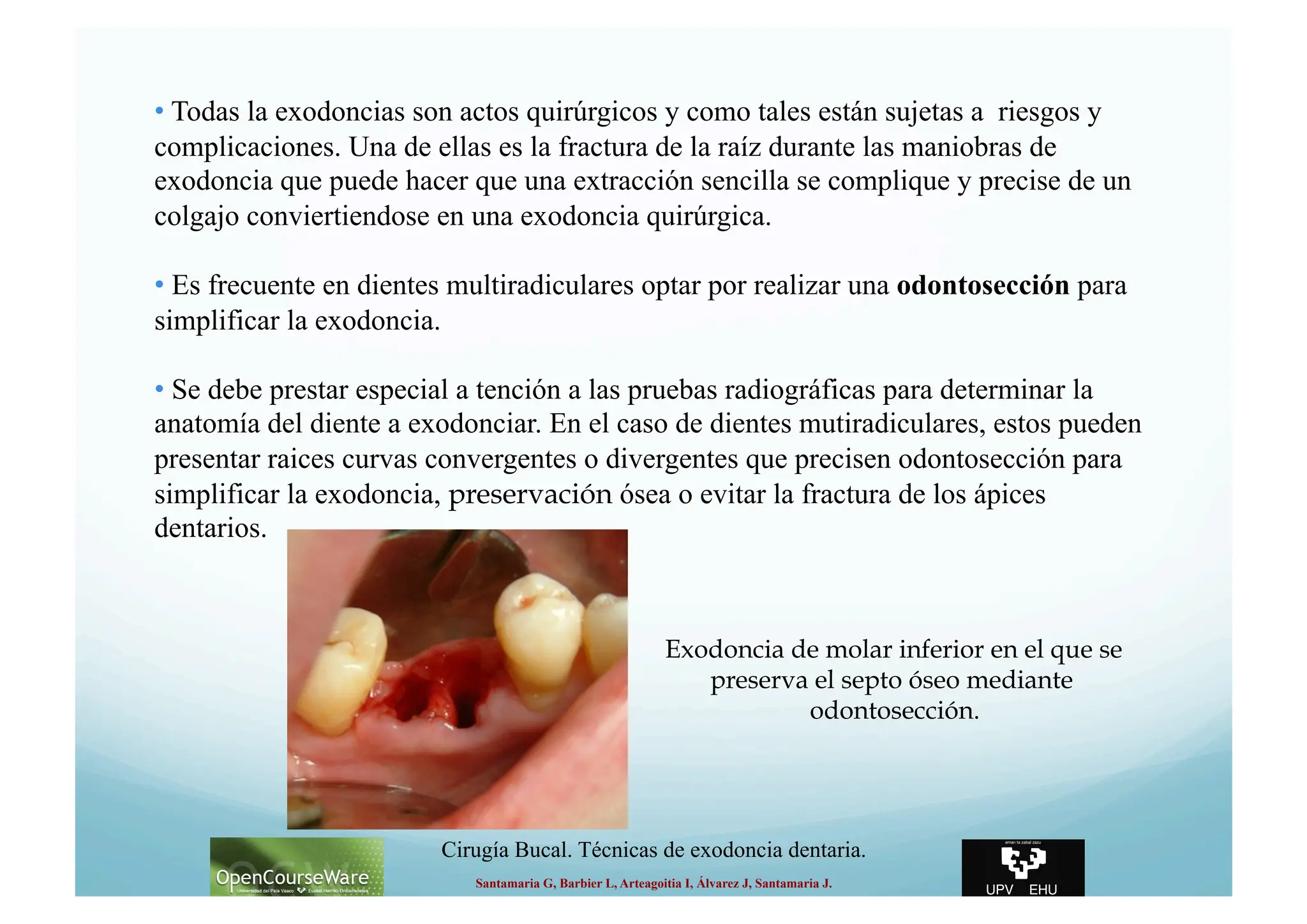 3.4_Extraccion_de_restos_radiculares._Extracciones_seriadas (1).pdf
