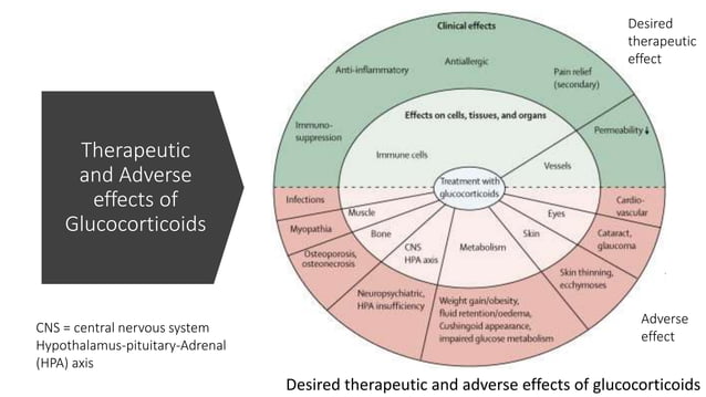 Ocular steroids-Dexamethasone, Betamethasone, Prednisolone and ...