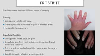 3.Environmental Emergencies 1.ppeknrvlnwvlenvltx | PPTX