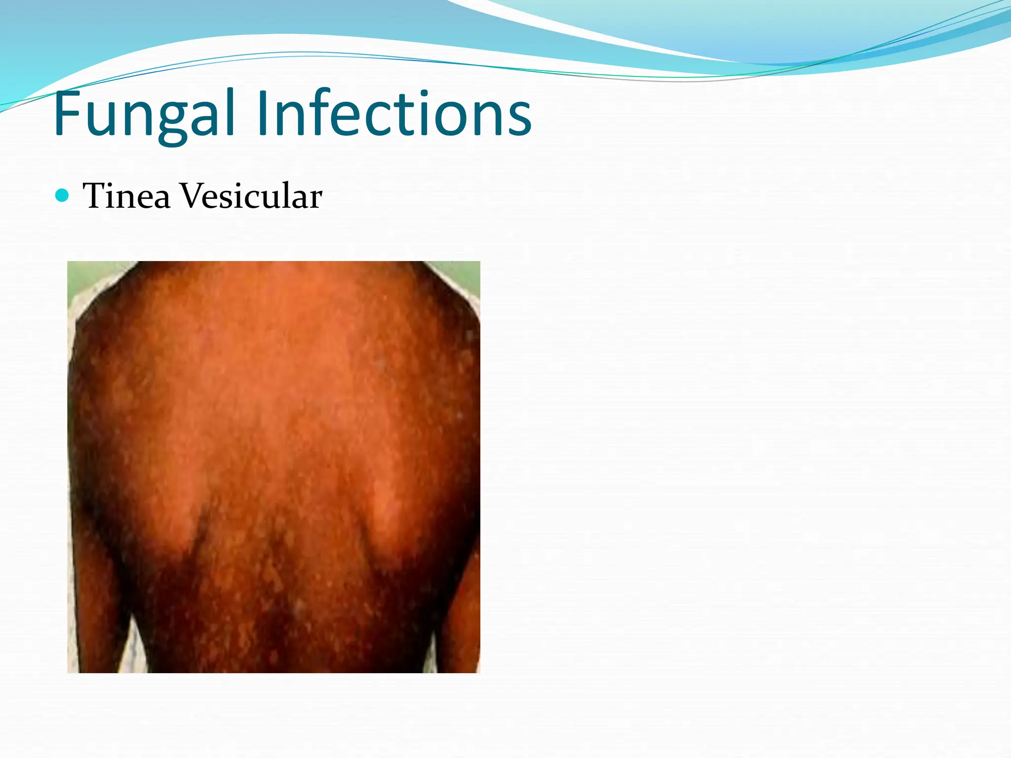 3.Skin, Hair & Nail Assessment.ppt Nursing | PPT