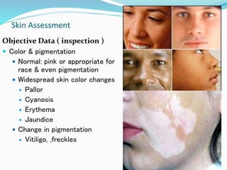 3.Skin, Hair & Nail Assessment.ppt Nursing | PPT