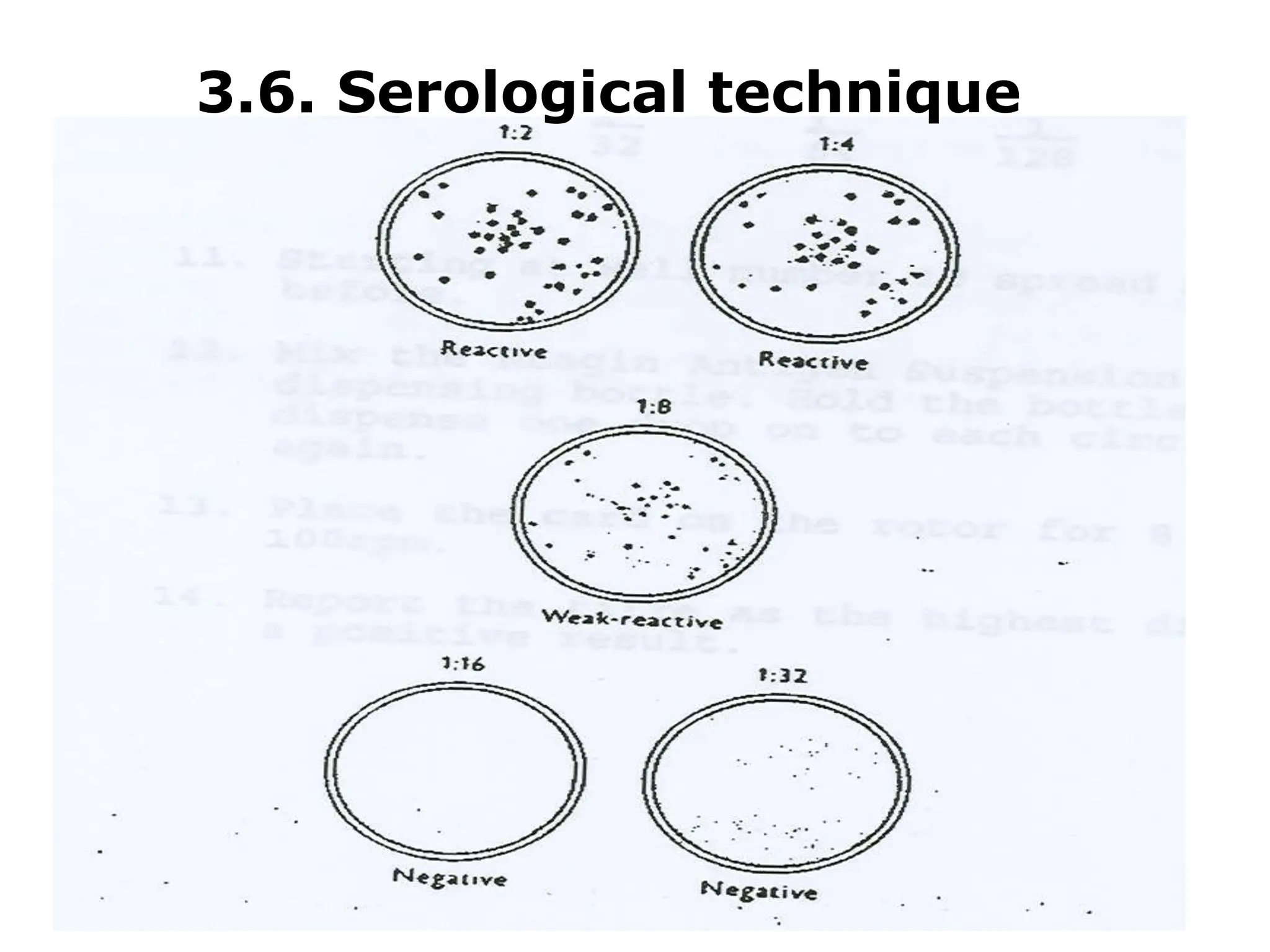 Syphilis Serology serological test for medical laboratory.ppt