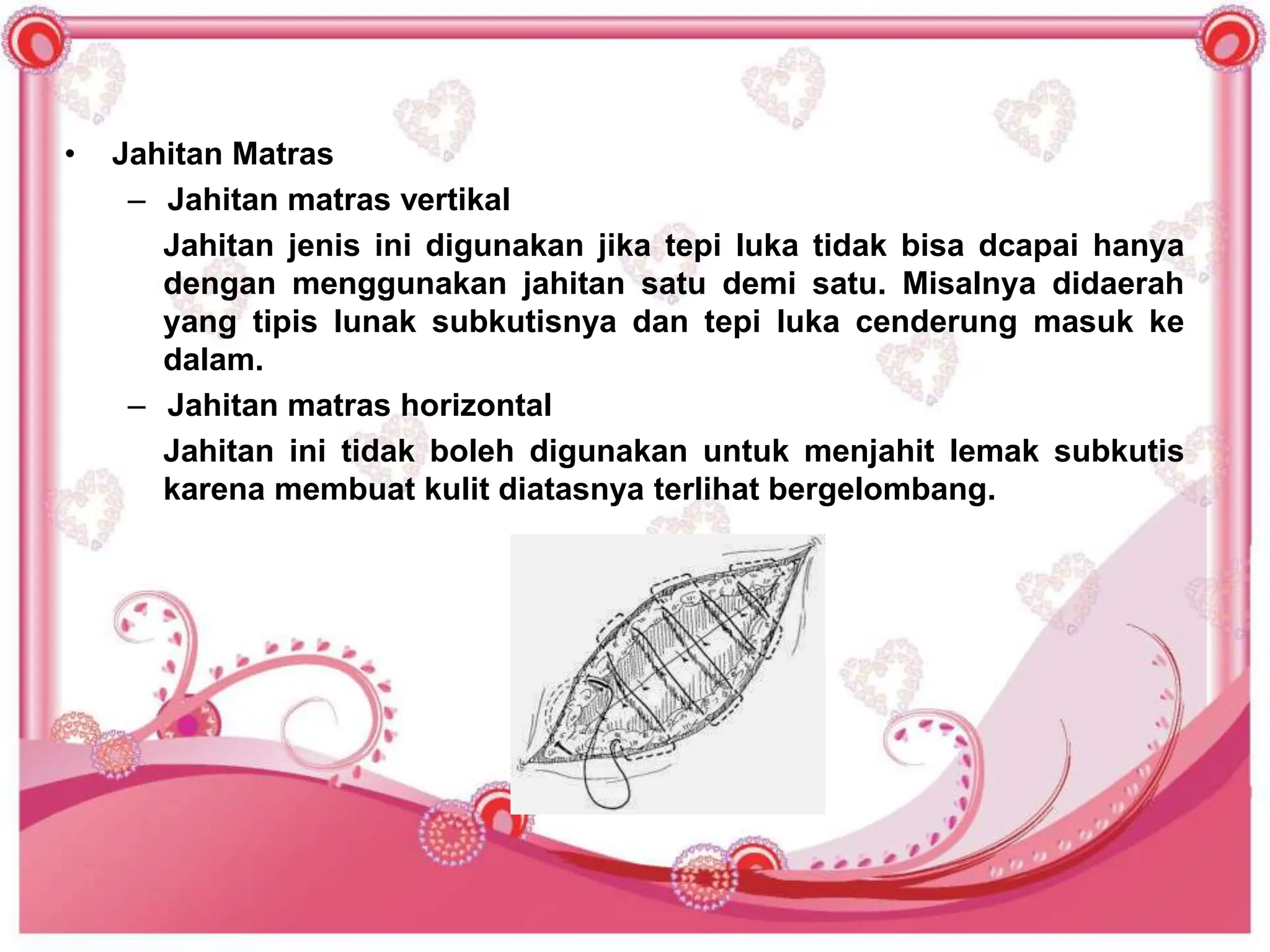 3. HEACTING LASERASI.ppt pada persalinan | PPT